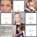 Infinity Cosmetic Med Spa | Cambridge Botox Dermal Filler Chemical ...